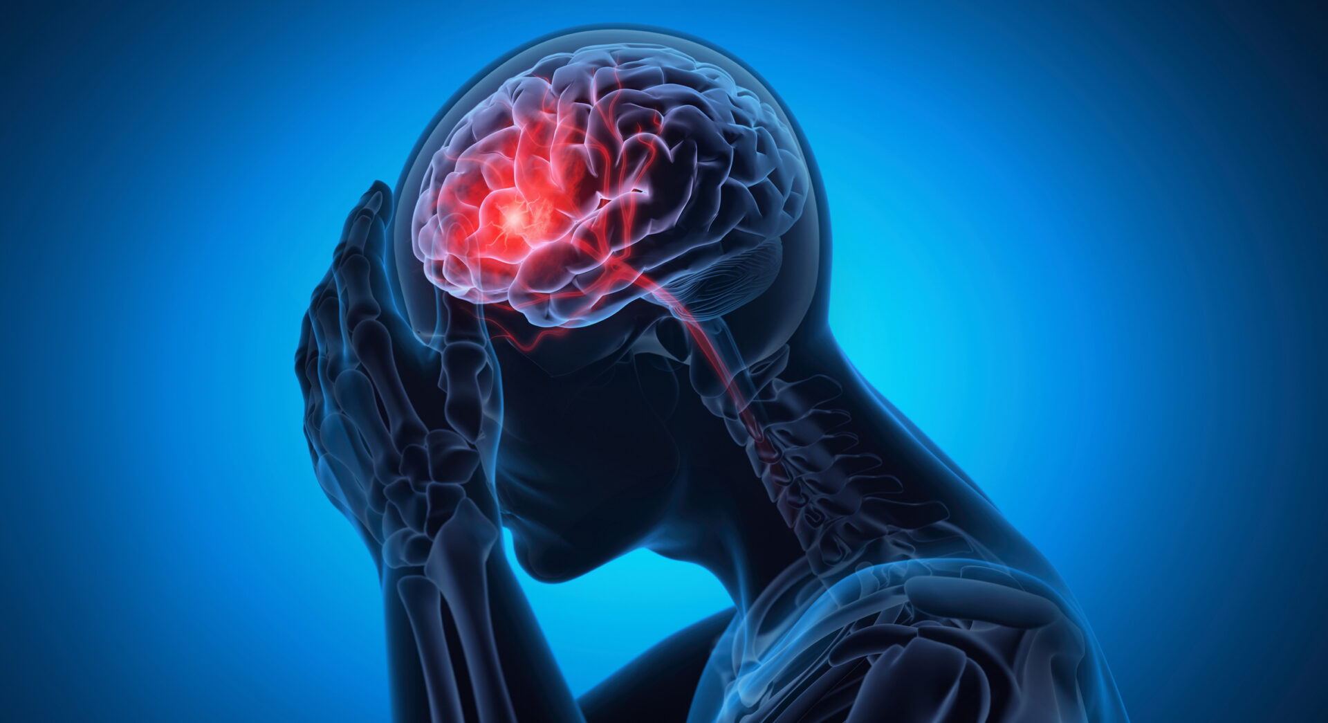 Understanding Stroke Symptoms - Covenant Health Understanding Stroke Symptoms - Covenant Health