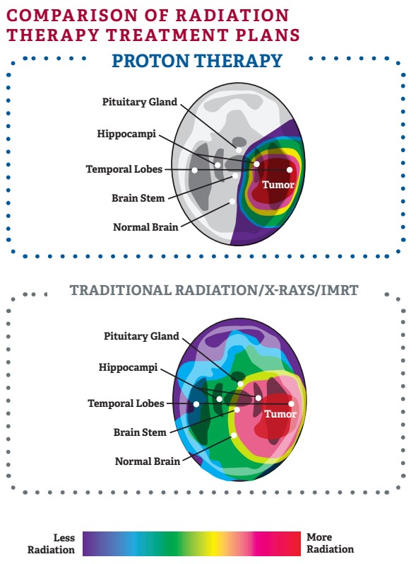 Proton Therapy for Cancer Treatment - Covenant Health